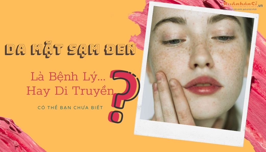 Da Mặt Bị Sạm Đen Là Bệnh Gì? Có Nguy Hiểm? Giải Pháp Là Gì?